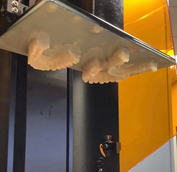 Retention After Braces | Ashton Orthodontics